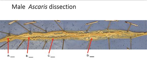 Ascaris Dissection Ascaris Dissection Lab
