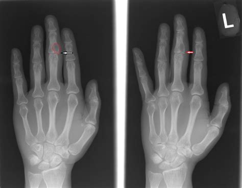 Что Такое Фаланга Пальца На Руке Фото — Картинки фотографии