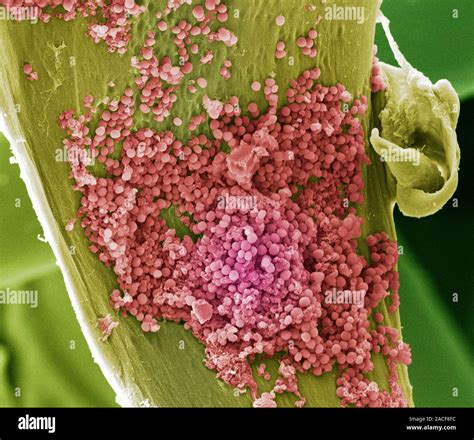 Mrsa Bacteria Coloured Scanning Electron Micrograph Sem Methicillin Resistant Staphylococcus