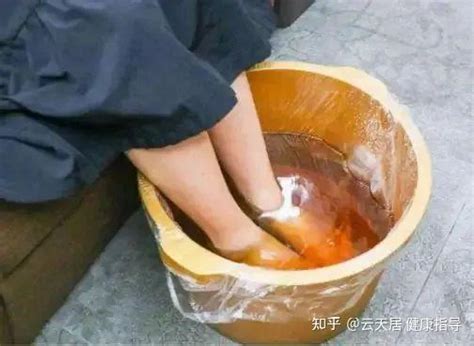 夏季湿气难除可能和情绪有关 知乎