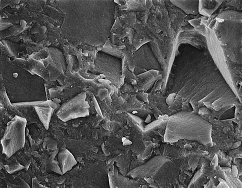 Resin Based Composites Pocket Dentistry