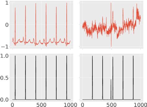 Figure 3 From Robust Ecg R Peak Detection Using Lstm Semantic Scholar