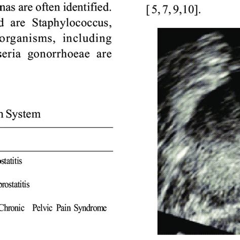 Trans Rectal Uss Shows Prostatic Abscess Download Scientific Diagram