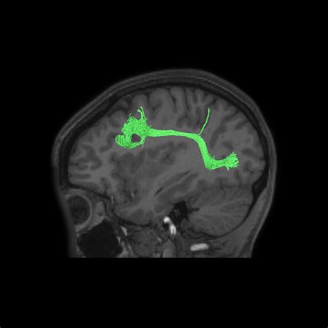Multiple Demand Network Connectome Guide