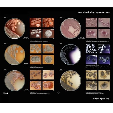 Streptomyces Species Colonies On Agar