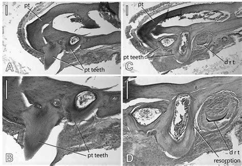 Fic 2 A B Transverse Sections Through Right Pterygoid