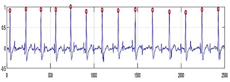 R Peak Identified Ecg Signal Download Scientific Diagram