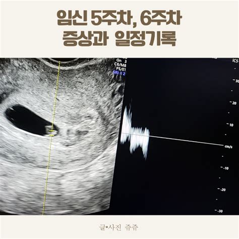 임신5주차 6주차 증상 기록 네이버 블로그