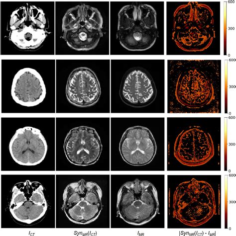 Figure 5 From Deep Ct To Mr Synthesis Using Paired And Unpaired Data Semantic Scholar