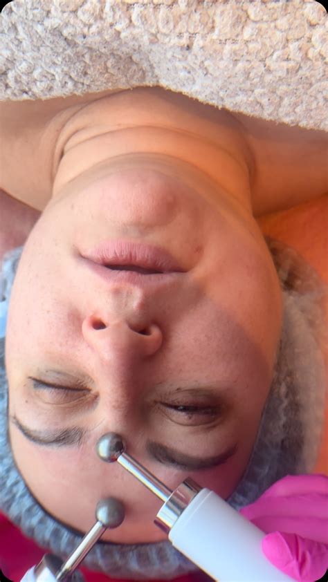 Косметолог Київ троєщина ботокс біоревіталізація мезотерапія Чим вмиватися якщо шкіра жирна🤔