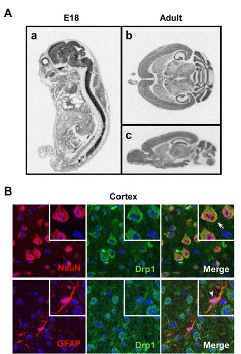 High Level Of Drp1 Expression In The Nervous System A In Situ Download Scientific Diagram
