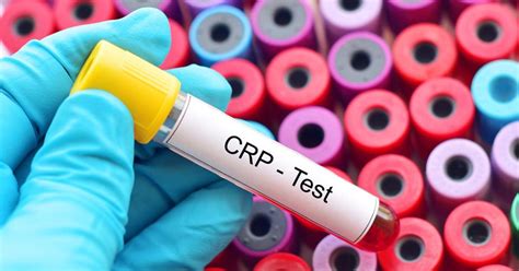 C Reactive Protein Test Has Multiple Applications Facty Health
