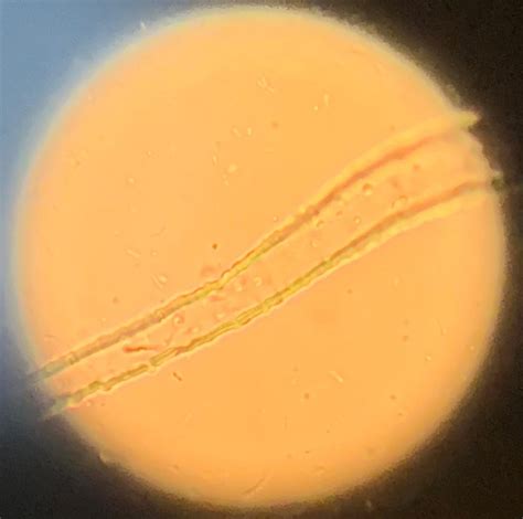 I Found A Worm Like Creature In A Fecal Float Today R