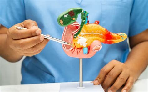 A Comprehensive Guide Of Distal Pancreatectomy Medisuggest