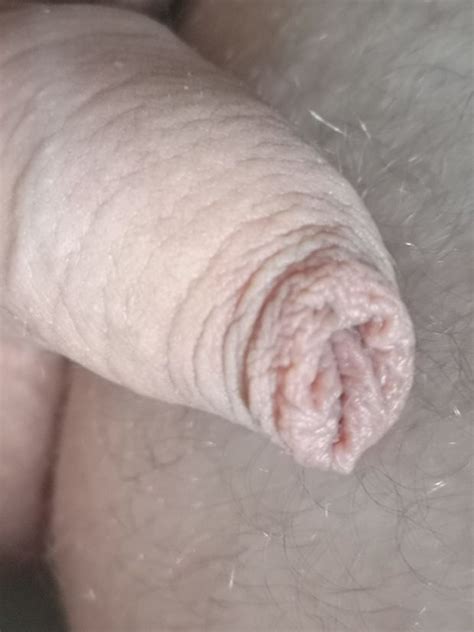 Foreskin Close Picture Pic