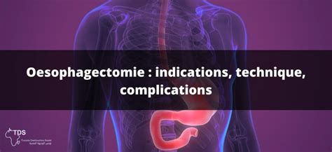 Oesophagectomie Indications And Techniques
