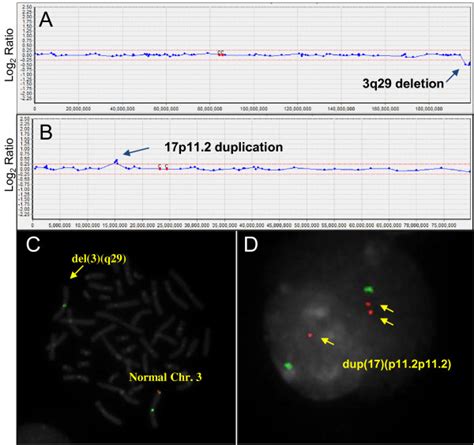 The Clinical Application Of Array CGH For The Detection Of Chromosomal Defects In 20 126
