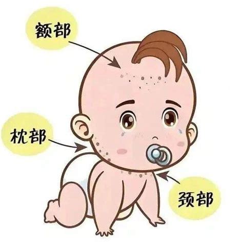 【健康科普】夏季宝宝被痱子折磨？教你清热解暑正确护理！皮肤皱褶衣物