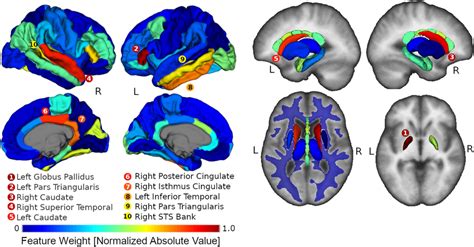 Visualization Of Model Generated From Brain Volumes From The Training Download Scientific