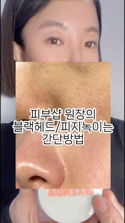 블랙헤드 피지 요철 가볍게 제거하는 방법 악센다 루티너 광주피부관리 파메스테틱 세멘시트 니기미봄므 블루블러드 광주파메스테틱 온라인홈케어코칭 오프라인홈케어