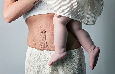 Post Pregnancy Photo Series Shows How Mothers Bodies Look After Giving