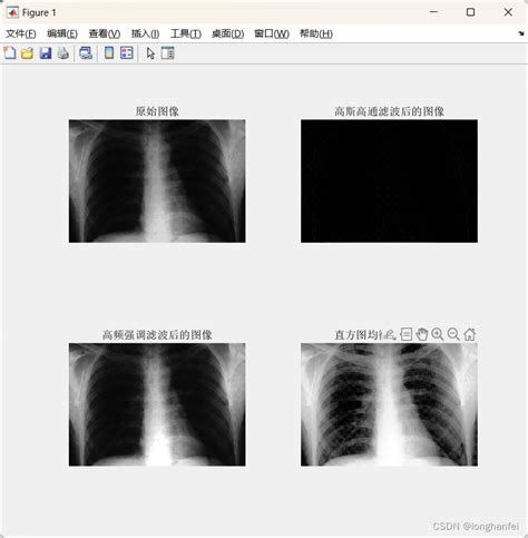冈萨雷斯数字图像处理（本科教学版）第三章课本习题全解matlab数字图像处理第三章答案 Csdn博客