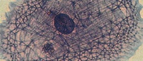 答生物教师问：细胞骨架属于细胞质基质还是细胞器？ 结构 体系 纤维