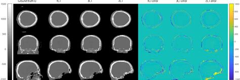 Figure 3 From Classical And Learned Mr To Pseudo Ct Mappings For