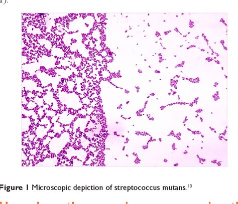 Streptococcus Mutans