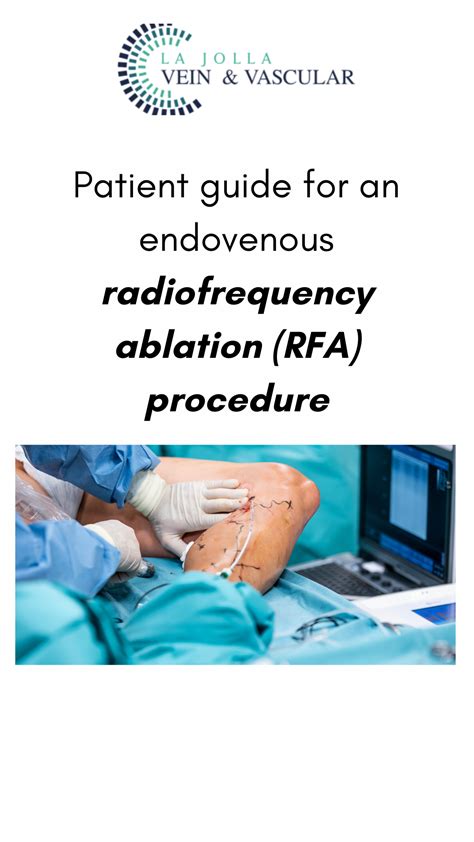 Patient Guide For An Endovenous Radiofrequency Ablation Rfa