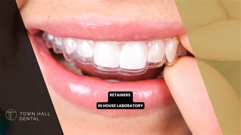 Dental Retainers In House Laboratory At Town Hall Dental Clinic