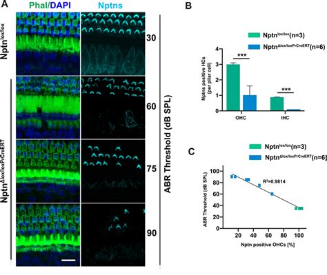 Correlation Of Abr Thresholds With Residual Neuroplastin Expression In