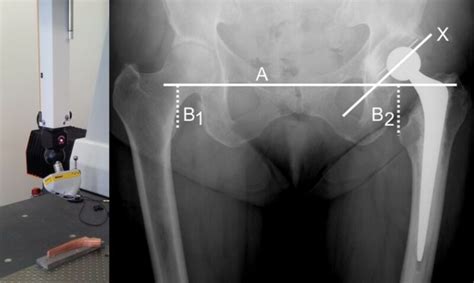 Additive Manufactured Medical Implants Lk Metrology