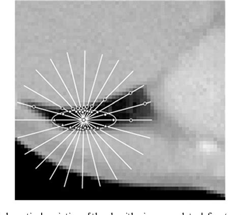 Figure 1 From Tensor Scale An Analytic Approach With Efficient Computation And Applications