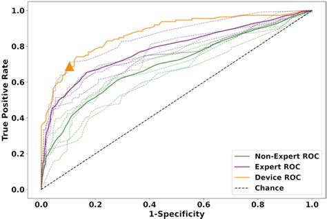 O 044 Large Vessel Occlusion Detection In Acute Ischemic Stroke On Non