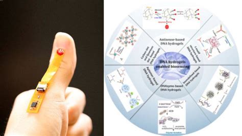 Wireless Technology Offers Possibility To Manage Medical Conditions By Sensor சனசர மலம