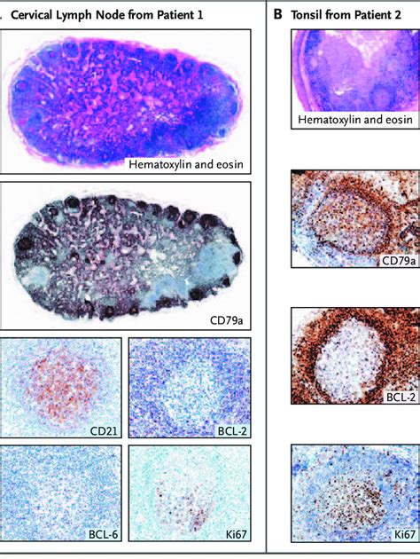 Germinal Center Lymph Node