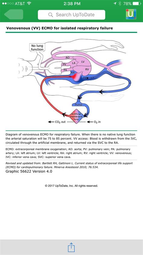 16 Best ECMO Images On Pinterest Ecmo Machine Nurse Life And Nursing Babes