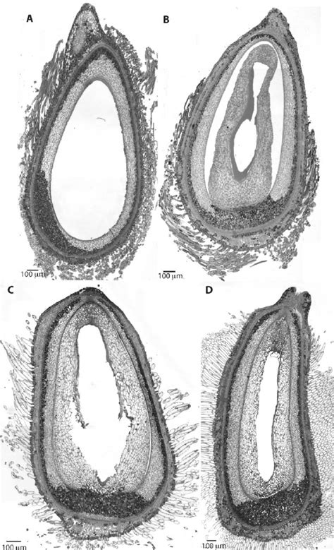 Median Longitudinal Sections Of 5 D Postanthesis Ovules Illustrating