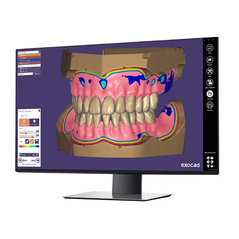 Exocad Installation Evolve Dentistry