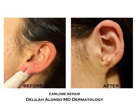 Alonso Dermatology Updated June 2026 24 Photos And 59 Reviews 6705