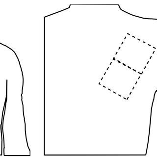 Age Gender And Amputation Details Of TMR Patients Download Table