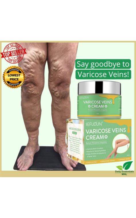 Крем за разширени вени Sefudun