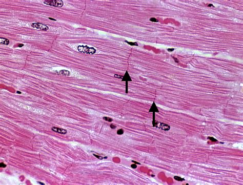 Cardiac Muscle