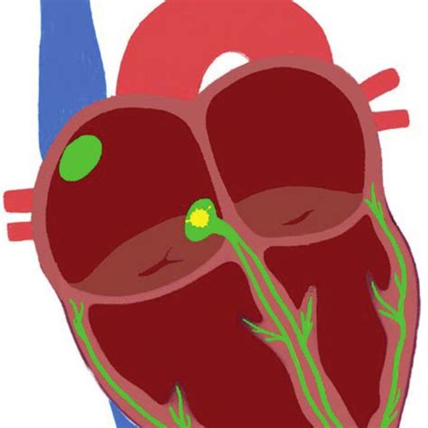 av node yellow drop sign generates impulses at a higher rate than download scientific diagram