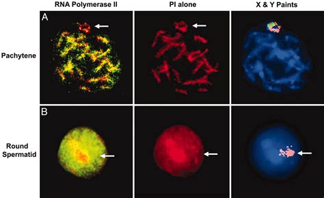 Dynamic Histone Modifications Mark Sex Chromosome Inactivation And