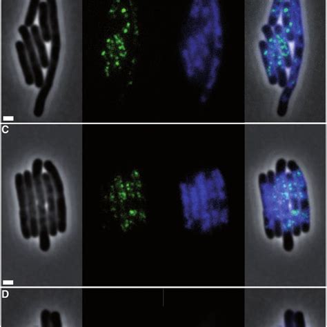 Localization Of Gfp Mrr And The Nucleoid Stained With Dapi In Mg1655