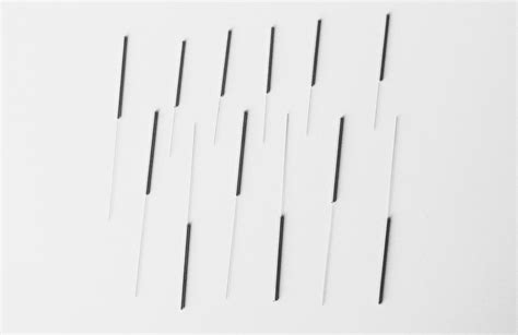 Balance Method Acupuncture