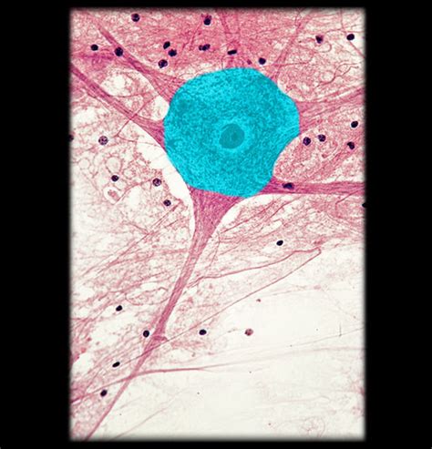 Neuron Spinal Cord Spinal Nerves Graphical ID Lab Practical III Flashcards Quizlet