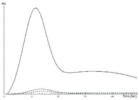 An Example Of Aif Arterial Input Function Selection And Download Scientific Diagram